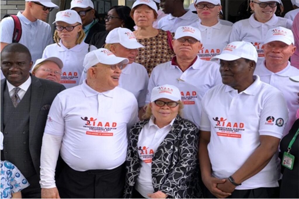 GROUP URGES GOVT TO IMPLEMENT POLICY ON EDUCATION FOR PWAS - Albinism ...