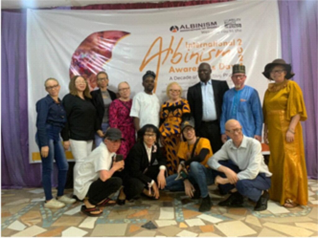 At Least Two People with Albinism Die Monthly Due to Skin Cancer in ...